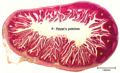 Peyer's Patches - Anatomy & Physiology - WikiVet English